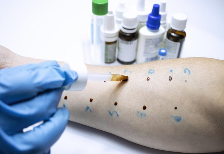 Best Drug Allergy Testing in Kolkata : Asthma & Allergy