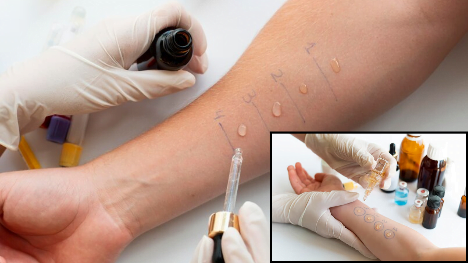 Best Drug Allergy Testing in Kolkata : Asthma & Allergy