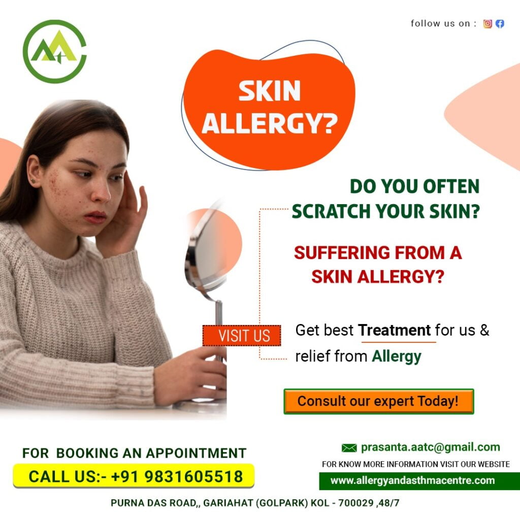 Best Skin Allergy Treatment in Kolkata | Expert Allergists Guide 2023 ...